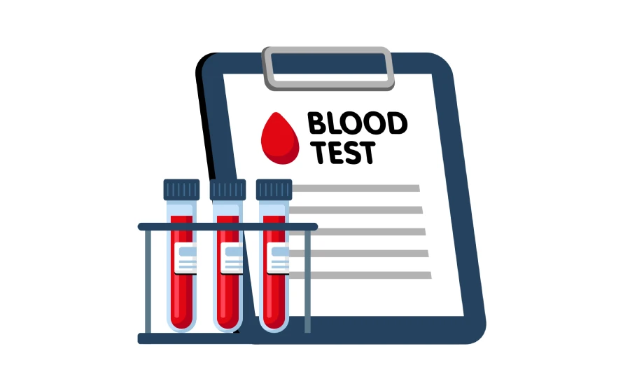 How Long for Blood Test Results in Ireland? What to Expect